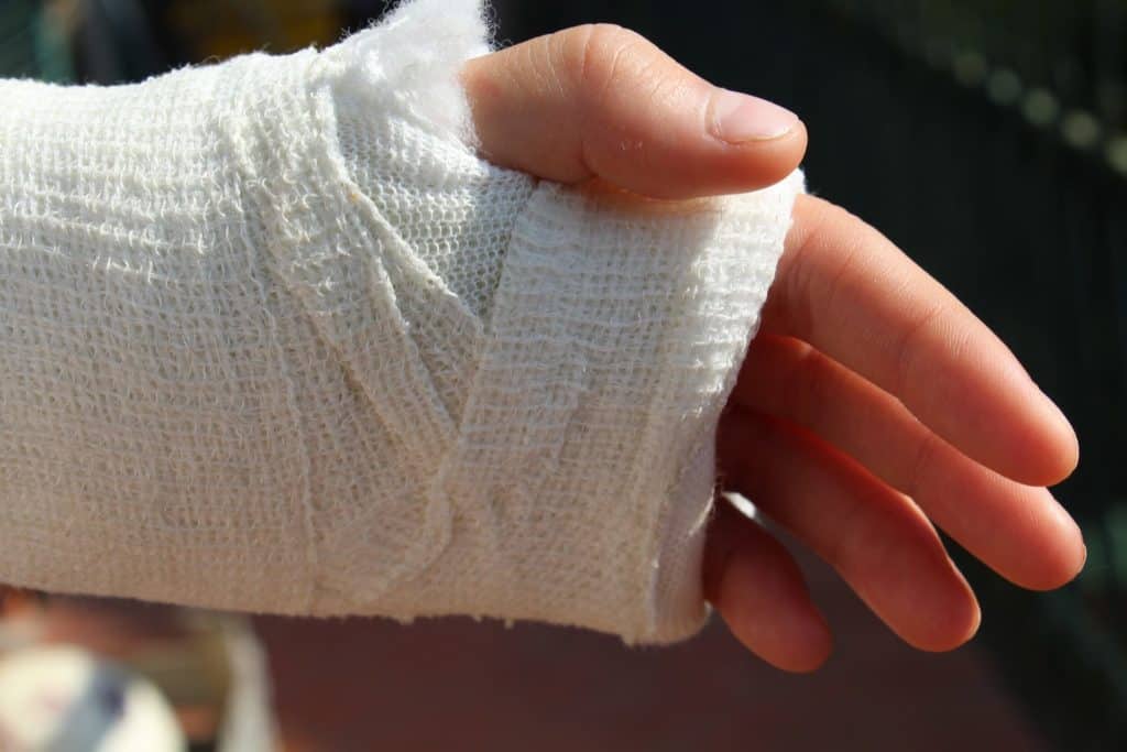 A Look At The Most Common Workplace Hand Injuries